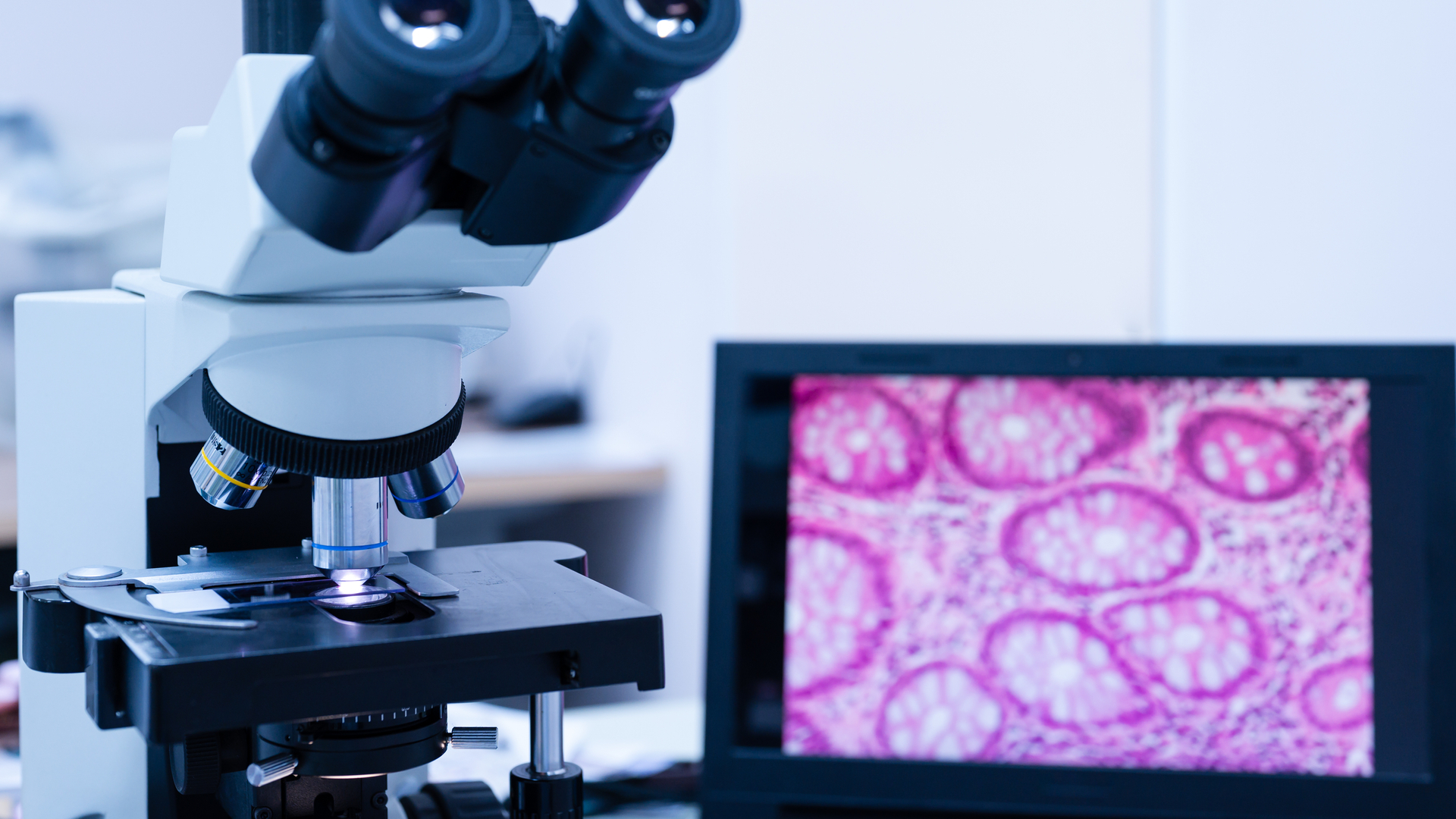 Prelievo citologico: cos'è, significato e citologia preventiva