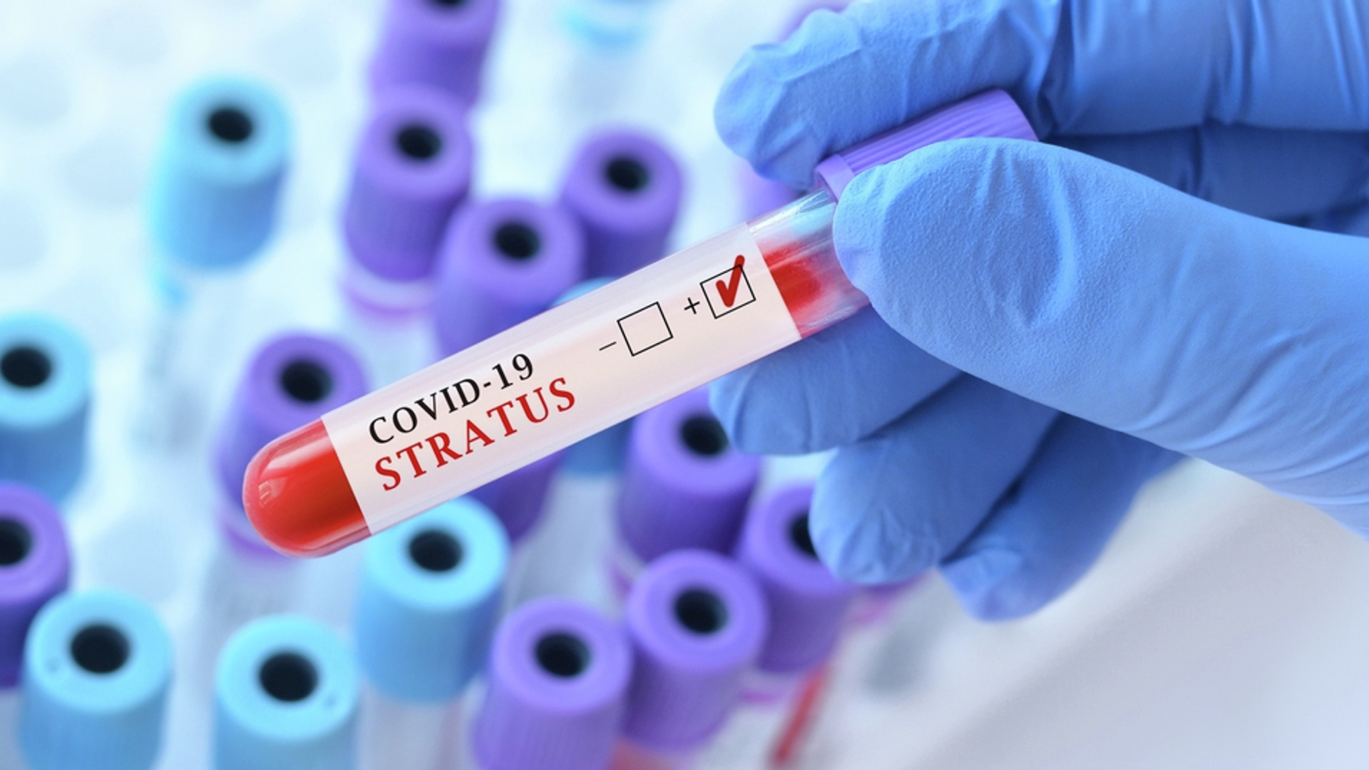 Variante COVID Stratus (XFG): sintomi e diffusione 2025